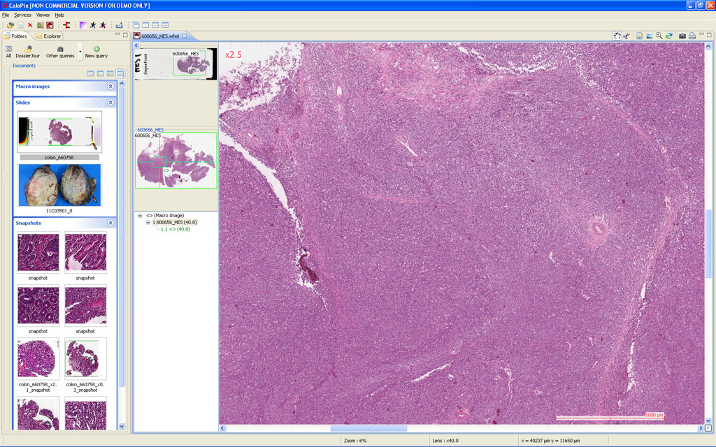 TRIBVN CaloPix Workstation CE Marked as a software for medical imaging ...