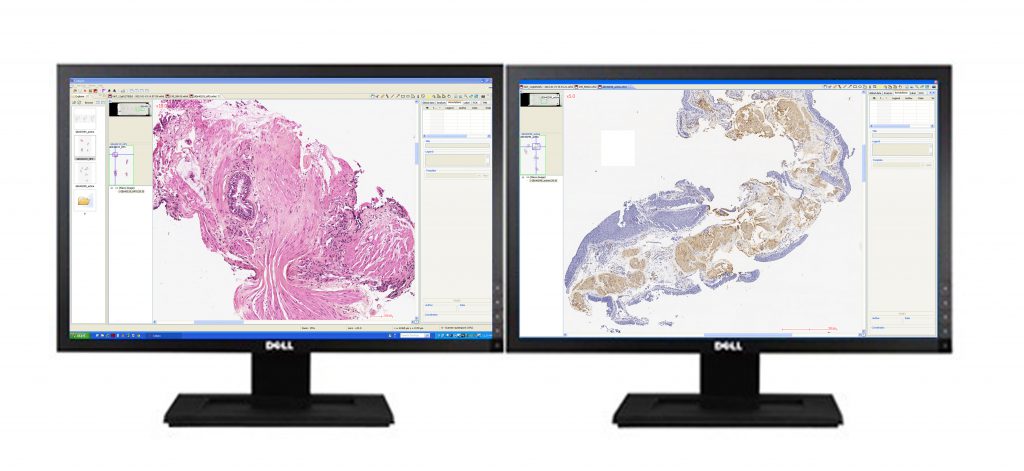 TRIBVN CaloPix Workstation CE Marked as a software for medical imaging ...
