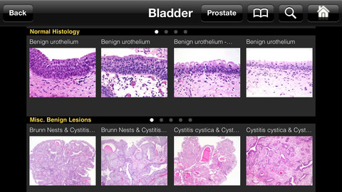 Check Out GU Path App | Tissuepathology.com