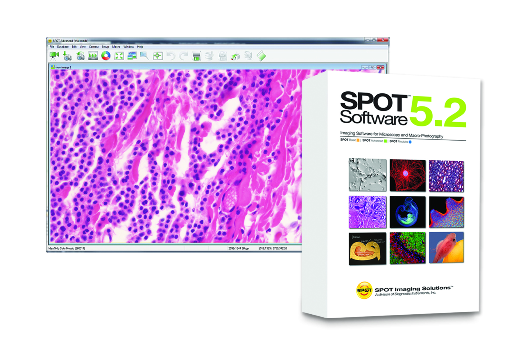 New SPOT 5.2 Software Release! | Tissuepathology.com