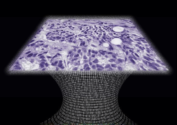 Portable Lens-Free Hollographic Microscopy Brings Pathology Lab ...