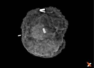Check Out PathVision from Faxitron | Tissuepathology.com