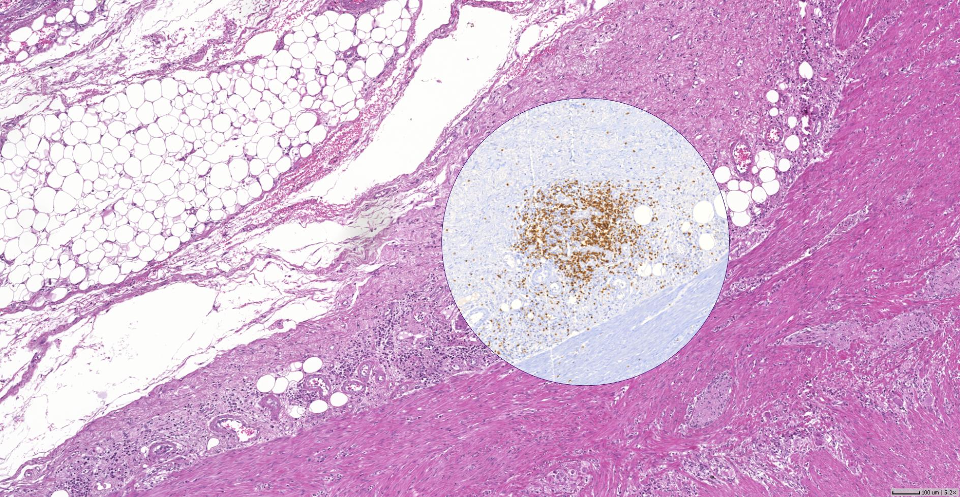 Zoom 2.0: Digital Pathology Viewer Now Features Multiple Image Viewing ...