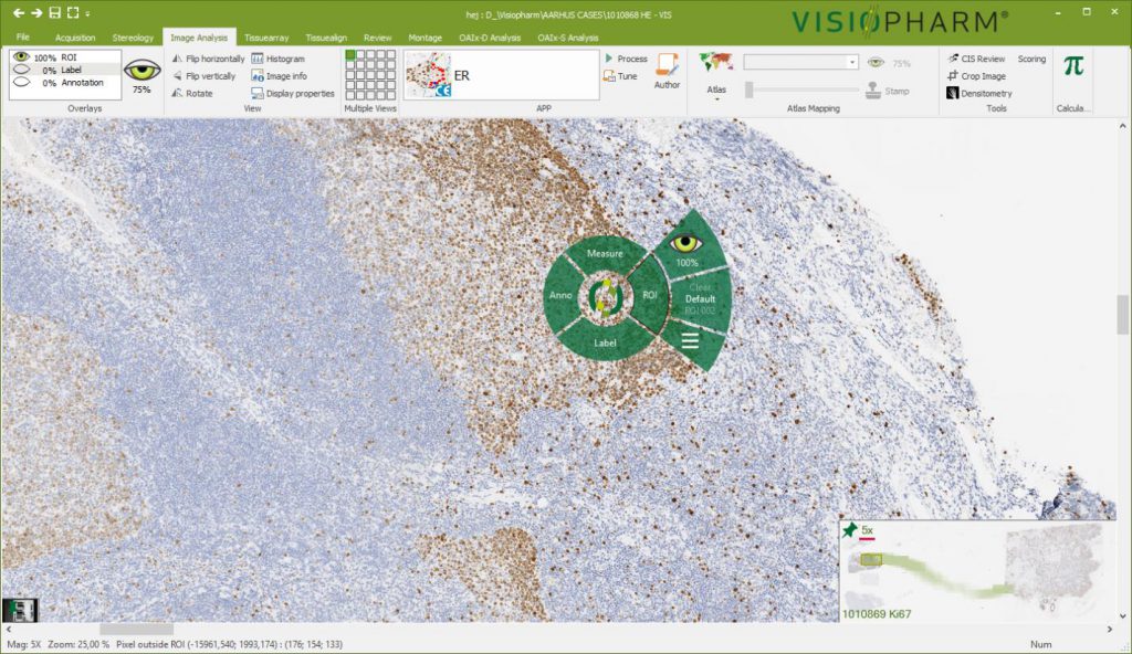 Visiopharm Pushes the Technical Boundaries of WSI Viewers ...