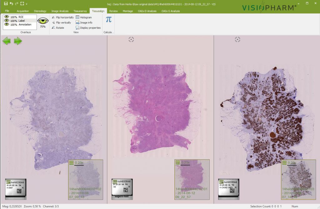 Visiopharm Pushes the Technical Boundaries of WSI Viewers ...