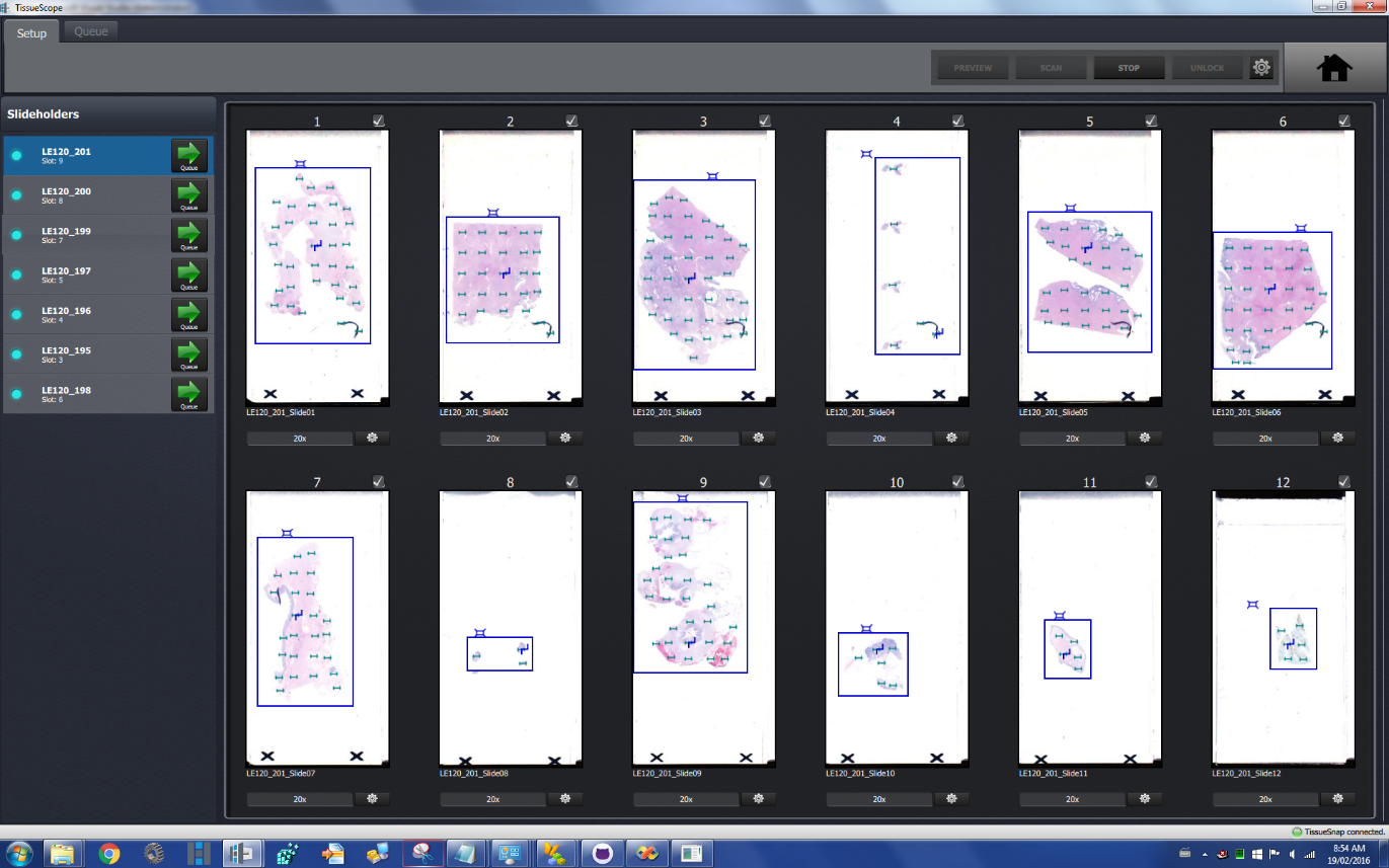 The Seven Pitfalls of Whole Slide Scanning | Tissuepathology.com