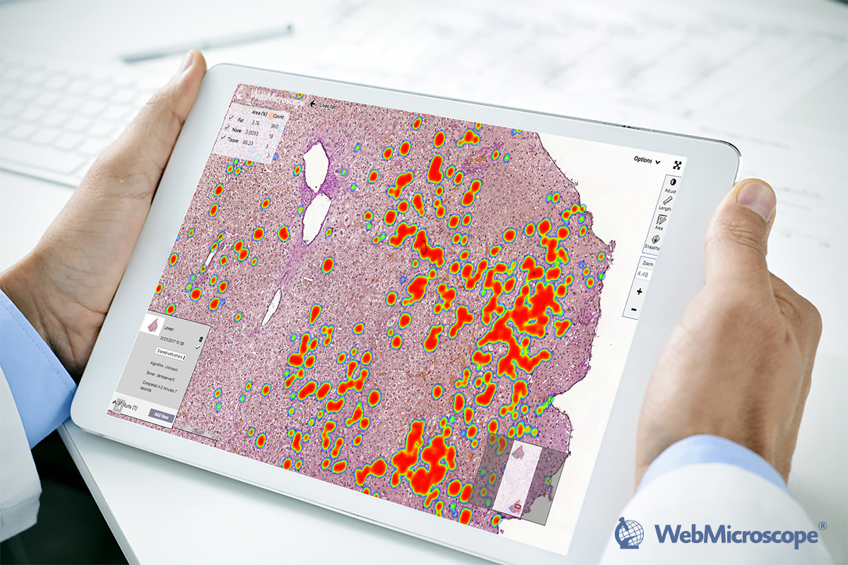 Fimmic Launches Deep Learning AI Analytics on Their Next-Generation ... Fimmic Launches Deep Learning AI Analytics on Their Next-Generation ...