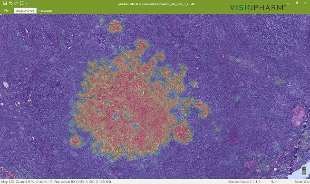 Visiopharm Engages in Major Initiative for Deep Learning in Tissue ...
