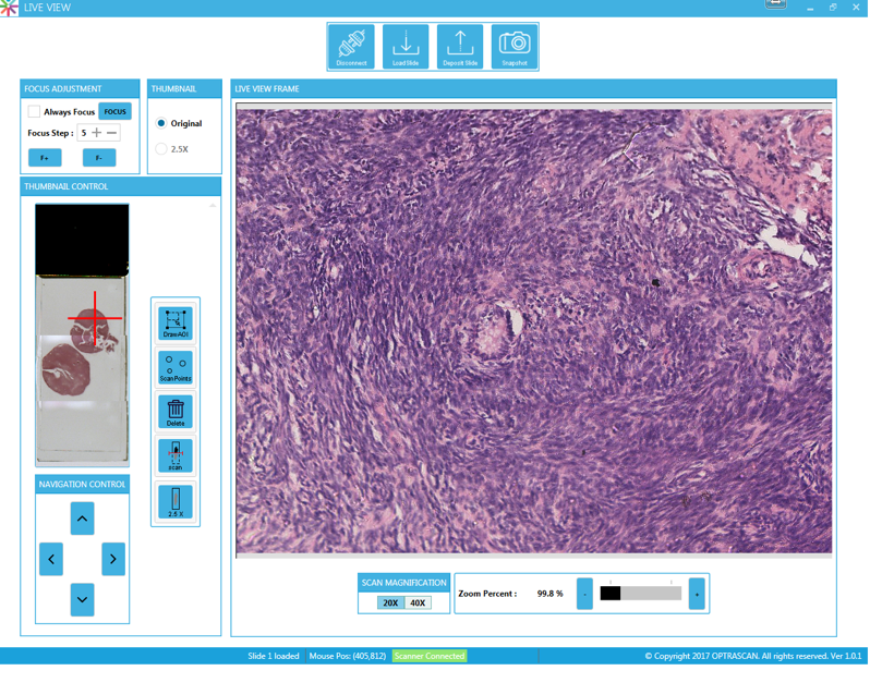 OptraSCAN Digital Pathology Launches Live View Mode, Frozen Sections ...