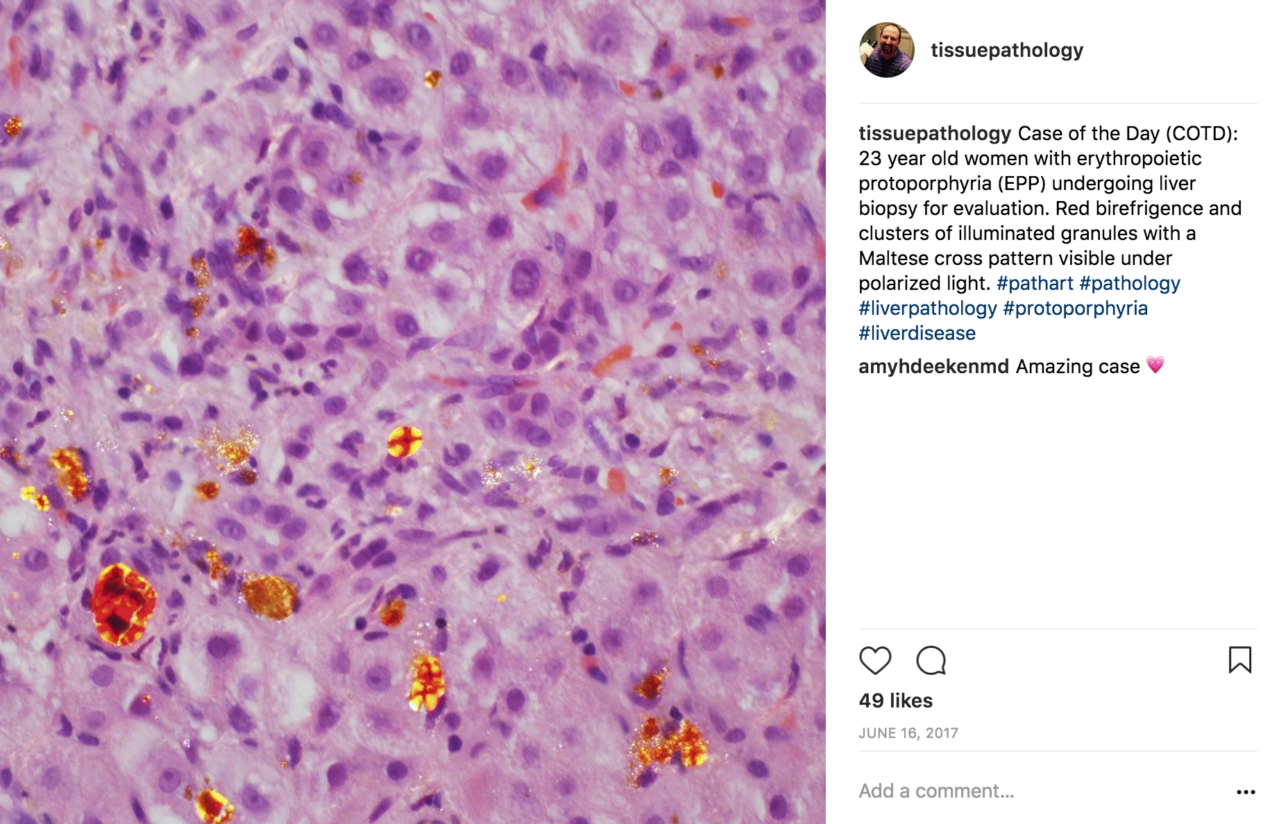 Pathology 2.0 – Nine Years Later | Tissuepathology.com