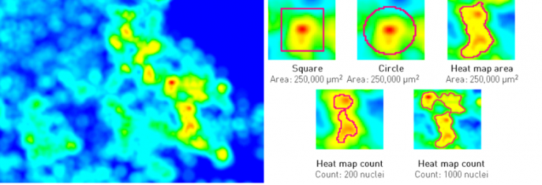 What Is a Hot-Spot and Does It Matter? | Tissuepathology.com