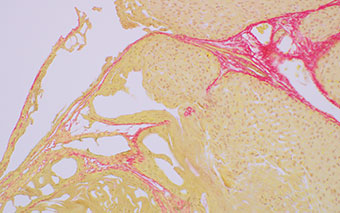 Identifying Collagen Fiber Types I and III Stained with Picrosirius Red ...