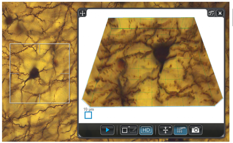 3DHISTECH Releases CaseViewer™ with Z-Stack 3D Visualization | Tissuepathology.com
