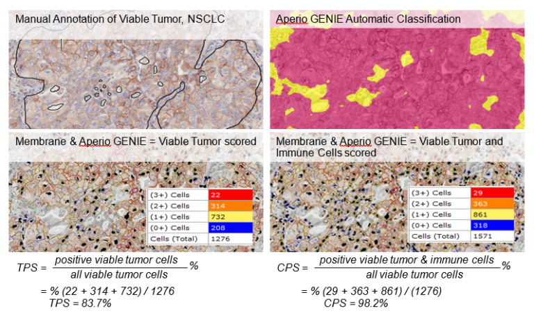 Tissue Classification To Direct Image Analysis of IHC Digitized Slides ...