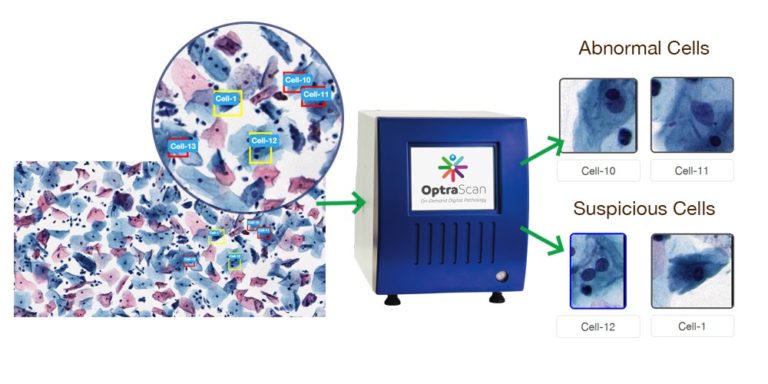 OptraSCAN to Expand into Digital Cytology Solution | Tissuepathology.com