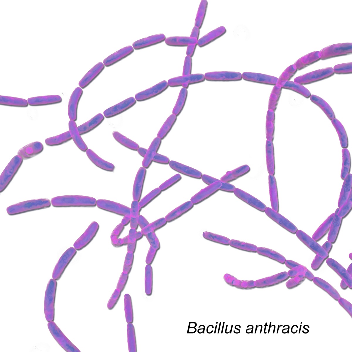 Dr. Kaplan, what is your BSL-4 capability? | Tissuepathology.com