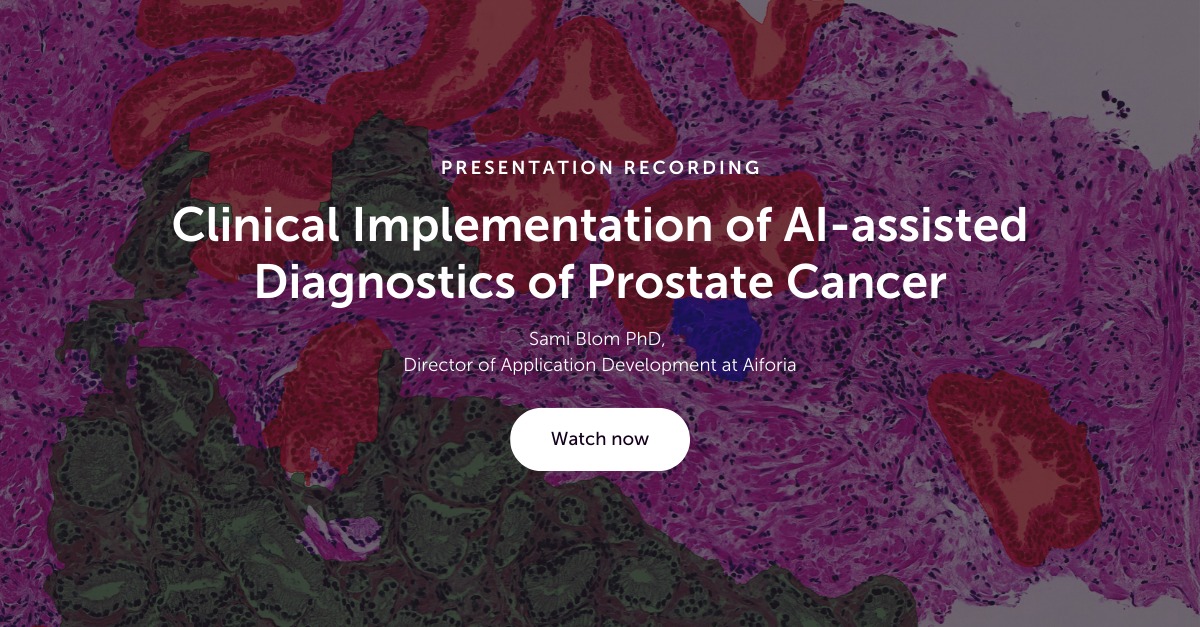 Clinical Implementation of AI-assisted Diagnostics of Prostate Cancer ...