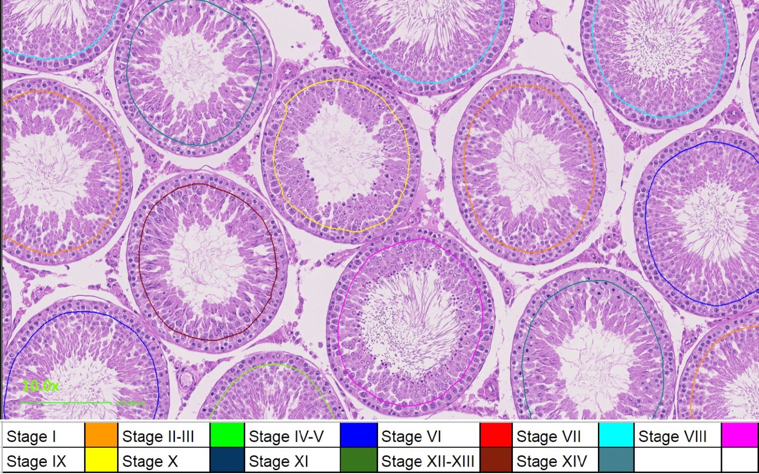 AIRA Matrix announces webinar series on AI applications in Reproductive ...