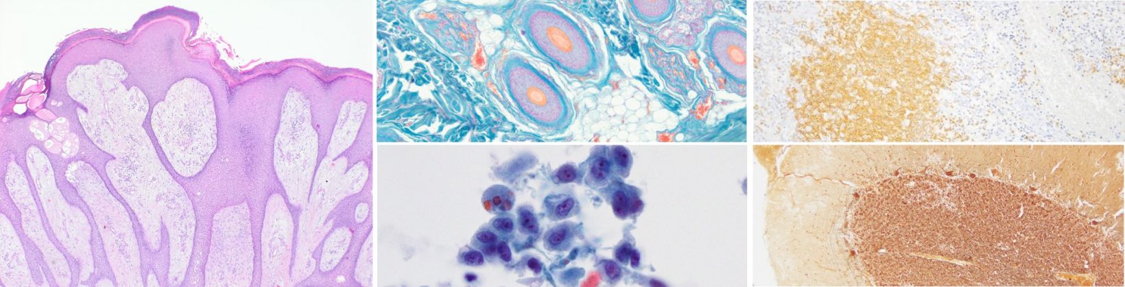 Webinar | Best Practices for Clinical Microscopy Cameras ...