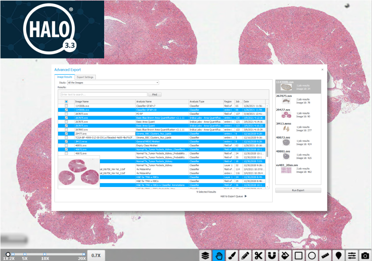 HALO and HALO AI 3.3 Sneak Peek | Tissuepathology.com
