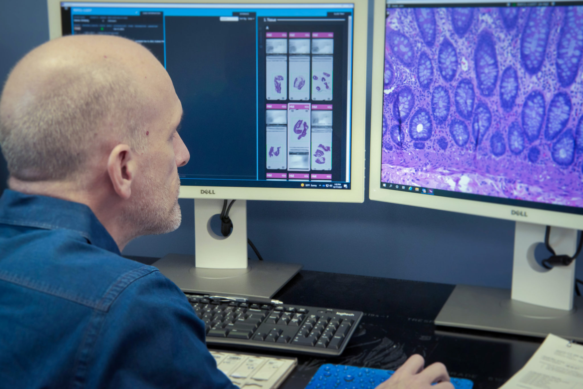 WVU Medicine Digital Imaging System | Tissuepathology.com