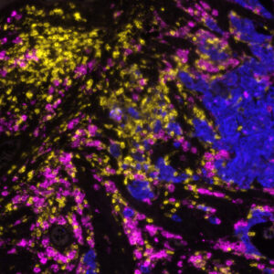 Lunaphore, Visiopharm: spatial biology | Tissuepathology.com