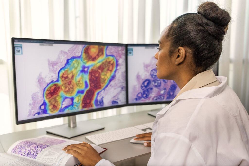 Ibex Outcomes AI Breast Cancer | Tissuepathology.com