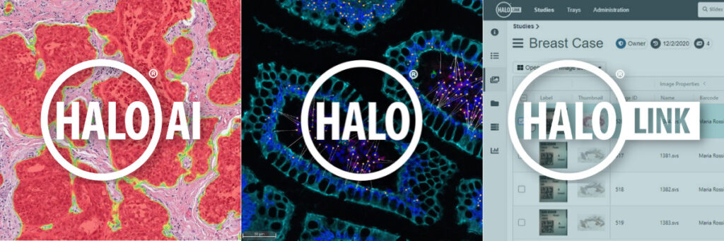 Indica Labs Upgrade Announcement | Tissuepathology.com