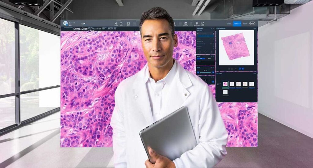 Roche: Evolution to Digital Pathology | Tissuepathology.com