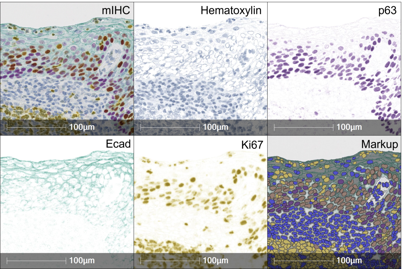 Indica Labs Multiplex IHC Webinar | Tissuepathology.com