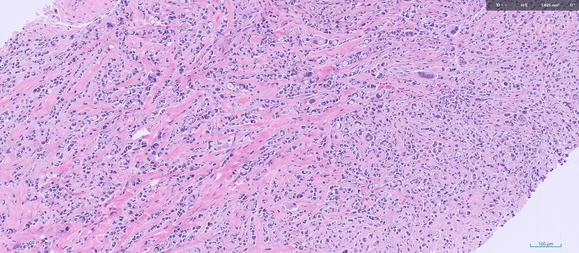 Digital pathology is just pathology | Tissuepathology.com
